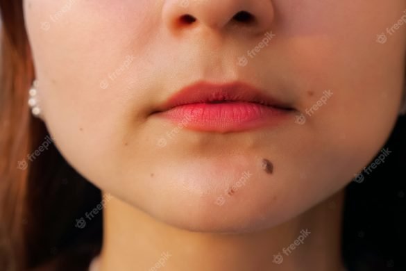 The Mystical Legends of Mongolian Birthmarks: Unraveling the Mythical Tales and Belief - Itechment