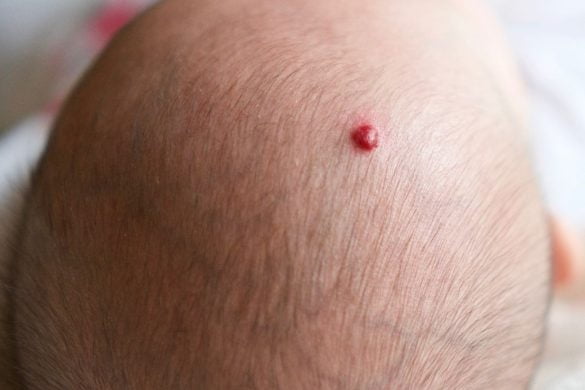 Decoding the Differences: Distinguishing Cancerous Lesions from Normal ...